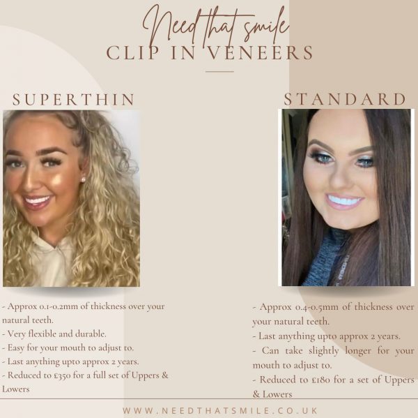 CLIP IN VENEERS - UPPER AND LOWER SET - IMPRESSION KIT INCLUDED - Clip ...